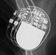 Jason Rubenstein, MD